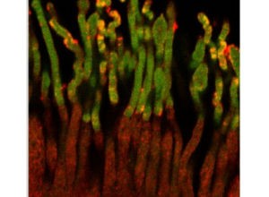Study Identifies New Mechanism That May Cause AMD