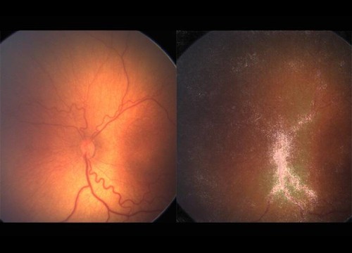 eyesmart.com.au - eyecare industry news and jobs in Australia and NZ